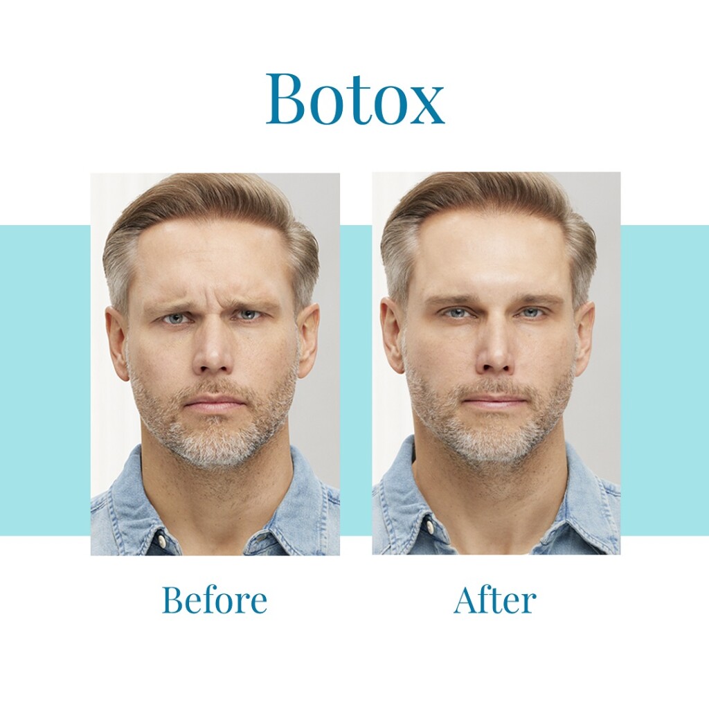 Best Botox Injections » Bella Medspa » Buckhead & Alpharetta